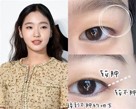 肿泡眼单眼皮双眼皮肿泡眼大山谷图库