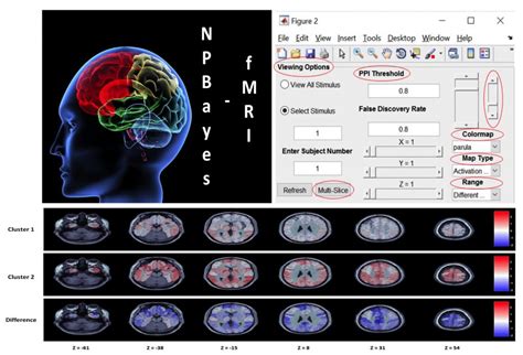 Github Rimehinpbayesfmri Bayesian Non Parametric Spatio Temporal