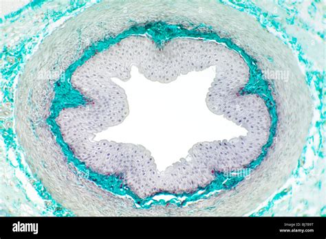 Brightfield Photomicrograph Of Ureter Of Rabbit Showing General