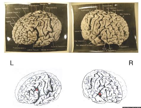 Albert Einsteins Brain 12 Facts About Gray Matter Of Scientific Genius Photos Huffpost