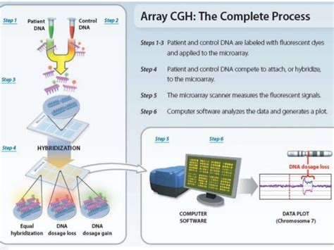 micro array based comparative genomic hybridisation dr yogesh d