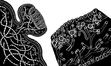 Lichens Diagram Nature Of Association Of Lichen Symbiosis And