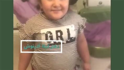 دختر با نمک ما بعد از ترمیم دندان نماشا