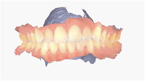 Aoralscan Elite Shining3ddental