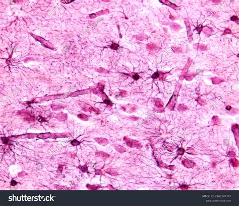 Astrocyte Histology