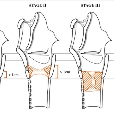 Myer Cotton Classification Adapted From Myer Et Al 3 With