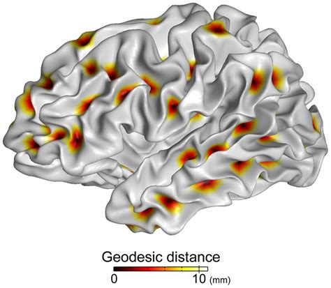 Geodesic Distance Map From Sulcal Pits As A Seed Point On The White