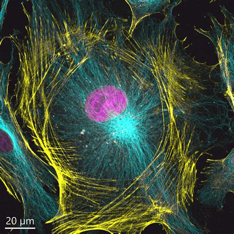 Dragonfly Confocal Microscope System Andor Oxford Instruments