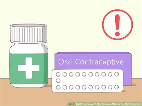 Ways To Prevent Dry Socket After A Tooth Extraction WikiHow