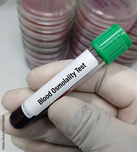 Osmolality