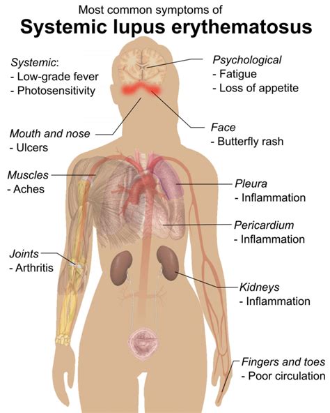 176 Disorders Of The Immune System Human Biology