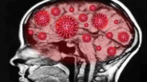 Researchers Investigate How Covid 19 Impacts The Brain The University