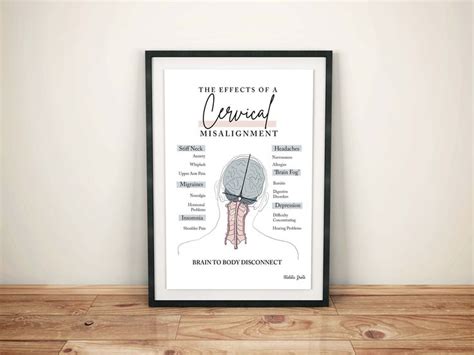 Cervical Misalignment Print Body Imbalance Print Spinal Nerve