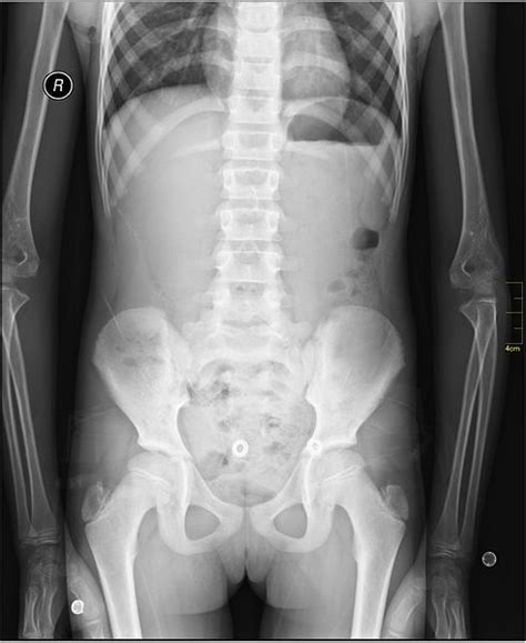 X Ray Images Body Anatomy X Ray