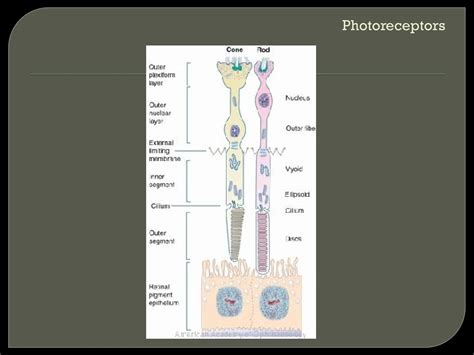 Common Retinal Disorders For Medicalpptx