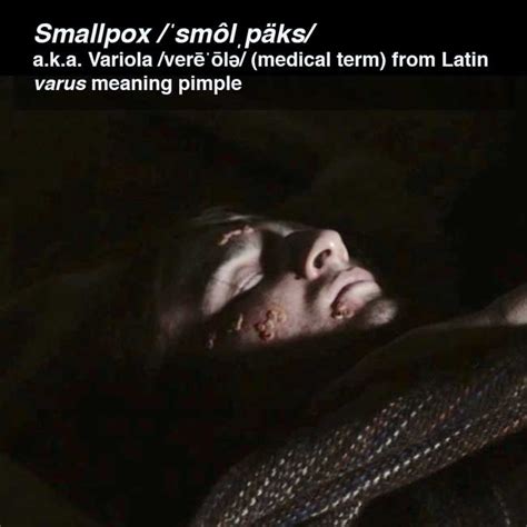 Smallpox Outlander Anatomy