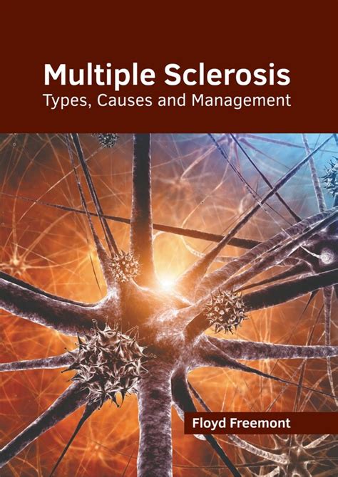 Multiple Sclerosis Types Causes And Management Indigo