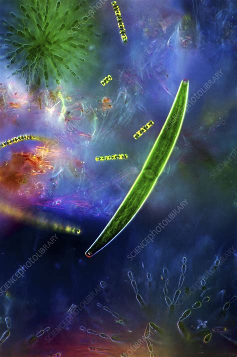 Desmids And Red Algae Light Micrograph Stock Image C0292947