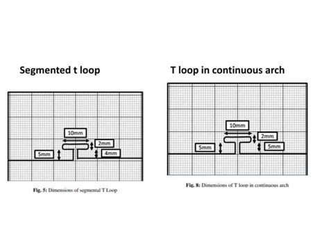 loops in orthodontics t loop bull loop vertical loop mushroom loop stop