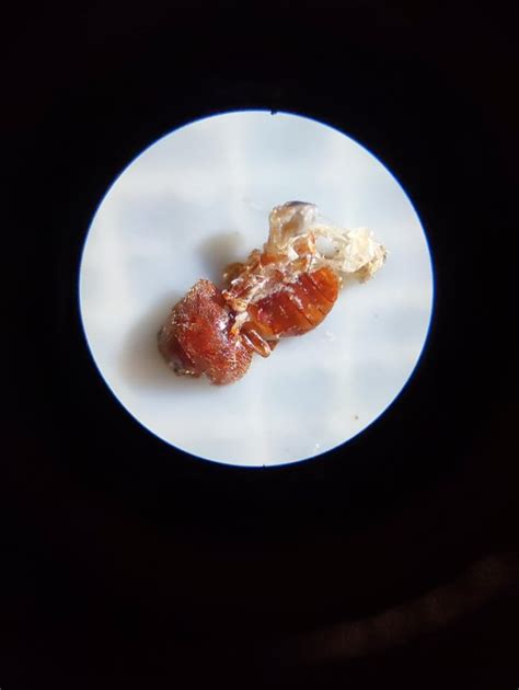 Help Identify Squished Bug Under A Microscope Rbedbugs