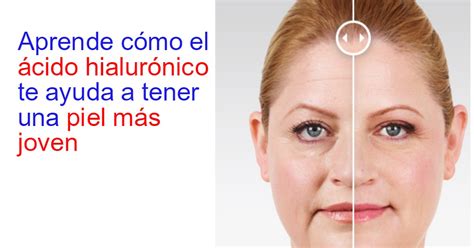Qué Es El ácido Hialurónico Y Como Nos Ayuda A Tener Una Piel Más Joven