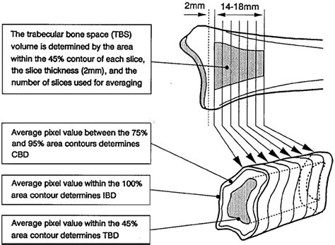 Measurement Site In The Ultra Distal Radius Using G Ct Bone Volumes