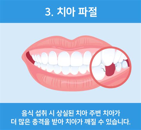 전주 임플란트 이건치과 치아 빠진 상태로 오랫동안 방치하면 빠진 치아 방치하면 안 되는 이유