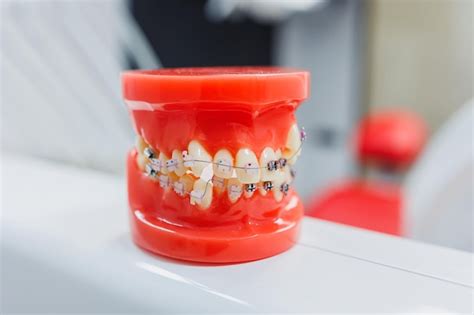 Premium Photo Plastic Figure Of A Human Jaw With Braces Model Of