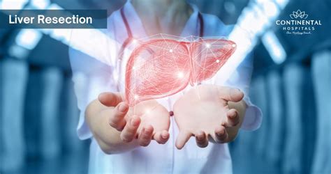 Liver Resection