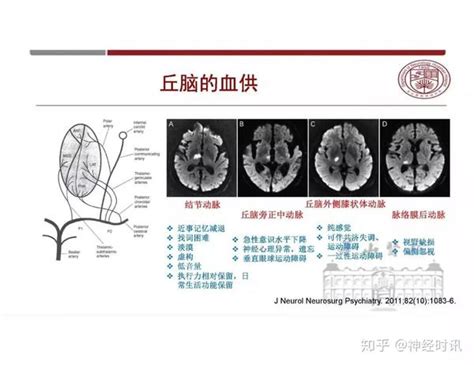 脑血管解剖太复杂？一文教你轻松掌握！ 知乎