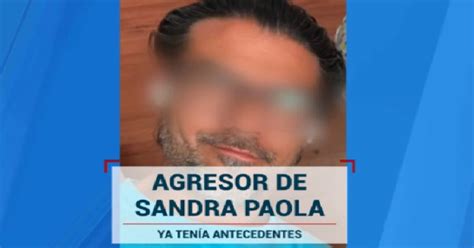 Sandra Paola Ya Había Sido Agredida En 2020 Por Su Exesposo