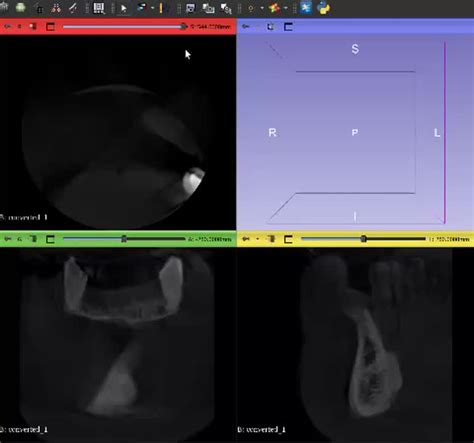 Medicalimaging Cbct 3dslicer Featureextraction Matlab