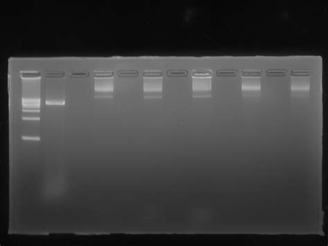 I Have The Wrong Size Of Plasmid After Ligation What Could Have
