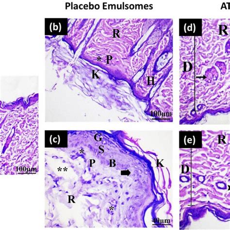 In Vivo Skin Irritation Test A Normal Skin This Shows The Two