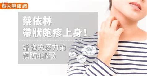 蔡依林帶狀皰疹上身！增強免疫力第一，預防4錦囊！
