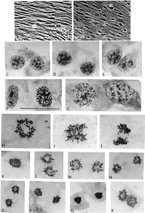 Nuclear Size And Mitosis Of F Dpcs Compared To Normal Fibroblasts A