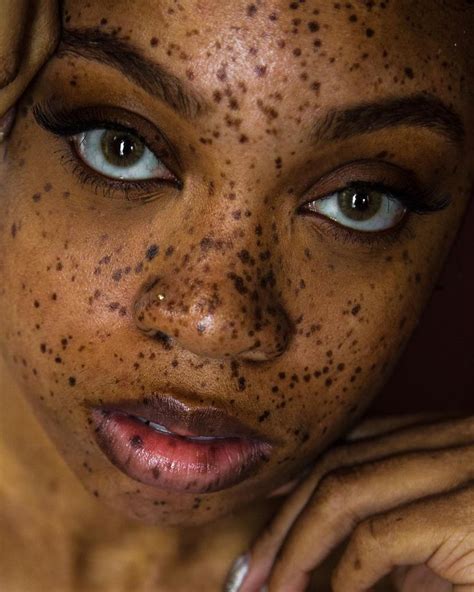 Beautiful Black Girls With Freckles Beautiful Freckles Freckles