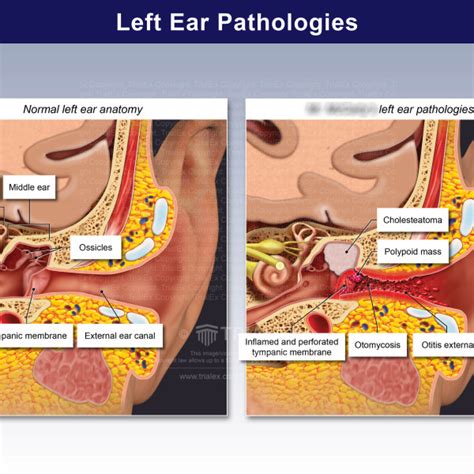 General Graphic And Medical Gallery Image Collection Trial Exhi