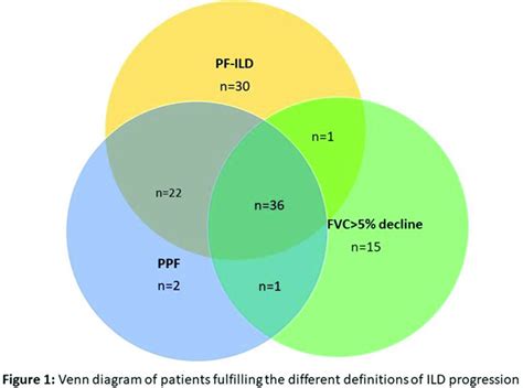 Pos1291 Prediction Of Mortality In Ssc Ild Depends On Definition Of Ild Progression Annals Of