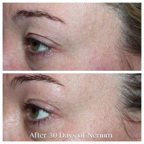 Clayandfetu Nerium This Is Our Friend Who Is On Our Team And Her