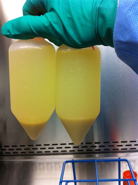 Human Islet Isolation Procedure Human Islet Transplant Laboratory