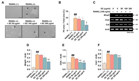 Exploring The Anti Osteoporotic Potential Of Daucosterol Impact On