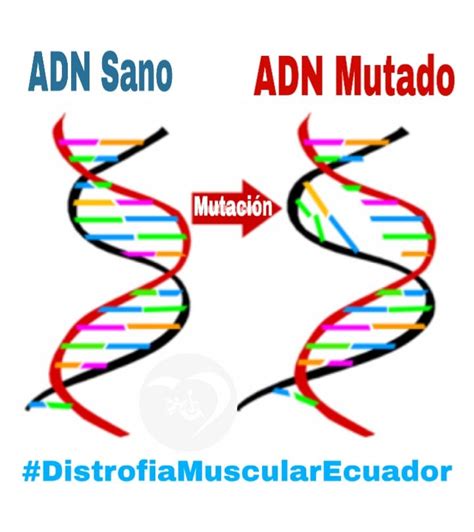 Undiagnosticonoeselfinal Fedimura Distrofiamuscularecuador