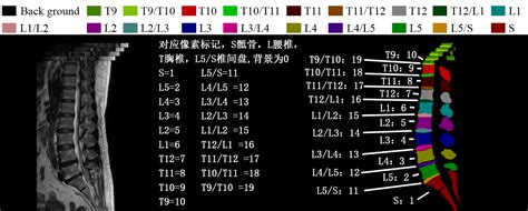医学影像基于Unet 实现脊柱MRI定位上 飞桨AI Studio星河社区
