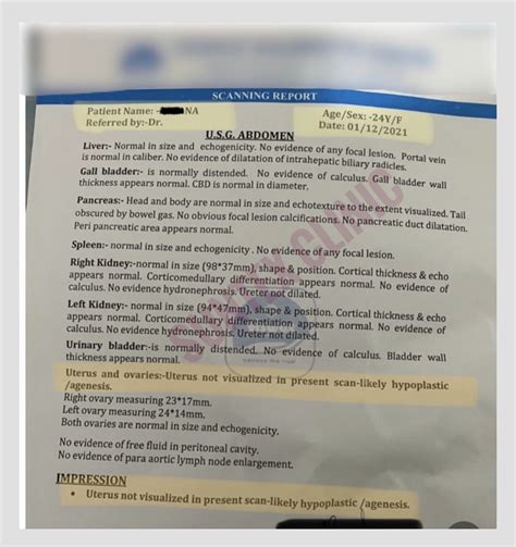 Uterus Agenesis Hypoplastic Suntex Clinic