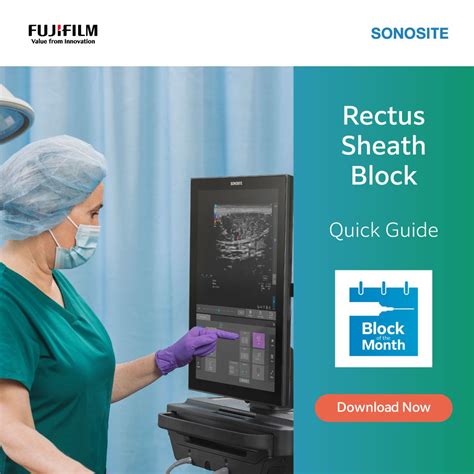Sneak Peek Inside The Rectus Sheath Block Guide This Months Resource