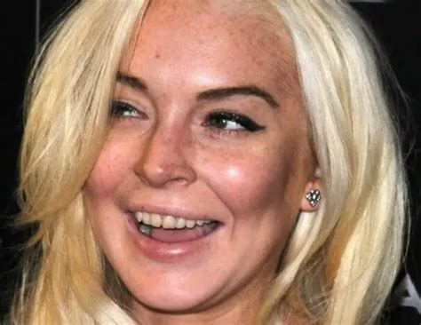 🦷 Lindsay Lohan New Teeth Now Beforeafter In 2025 Lema