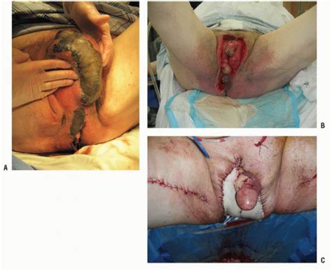 C FF Gif Abdominal Key