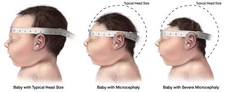 Evolutie Blog Wat Het Zika Virus Ons Leert Over De Potenties Van Het