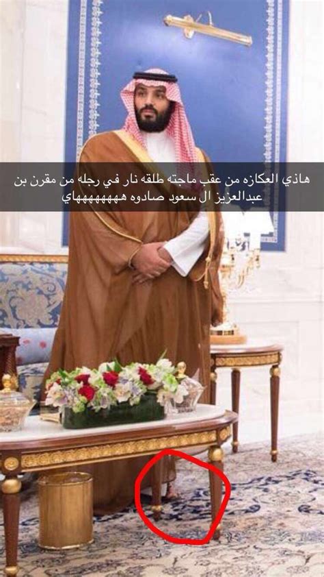شاهد الصورة ظهور محمدبنسلمان على عكاز بعد اصابته بطلق نارب من قبل